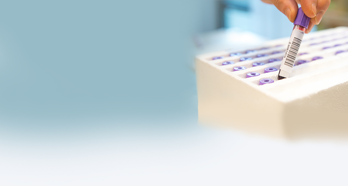 Versandmaterial | Biocontrol